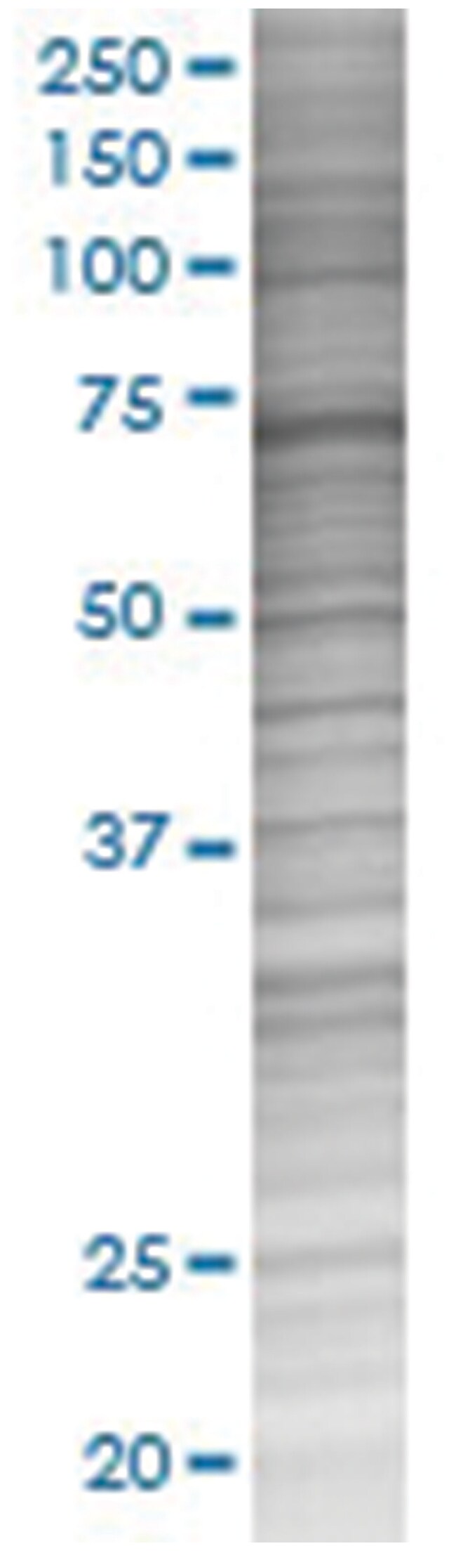 ALF 293T Cell Overexpression Lysate (Denatured), Abnova 100μL:Protein ...