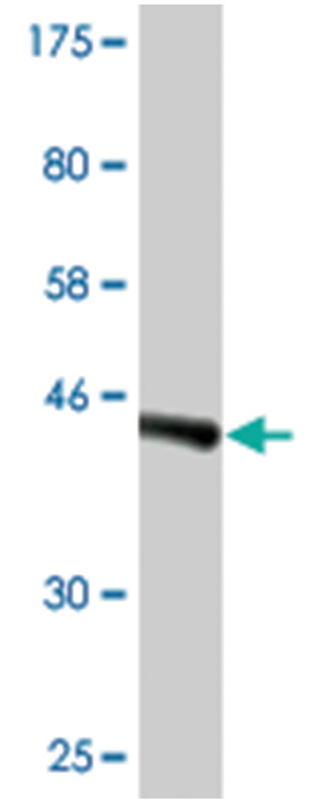 STMN2 (M23A), Mouse anti-Human, Clone: 1A7, Abnova™ 200μL; Unlabeled ...