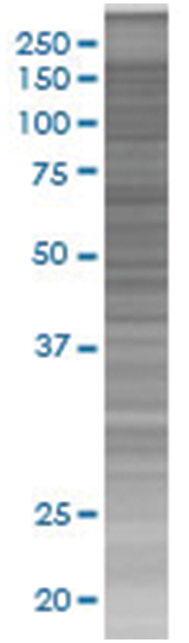 SORCS3 293T Cell Overexpression Lysate (Denatured), Abnova 100μL ...