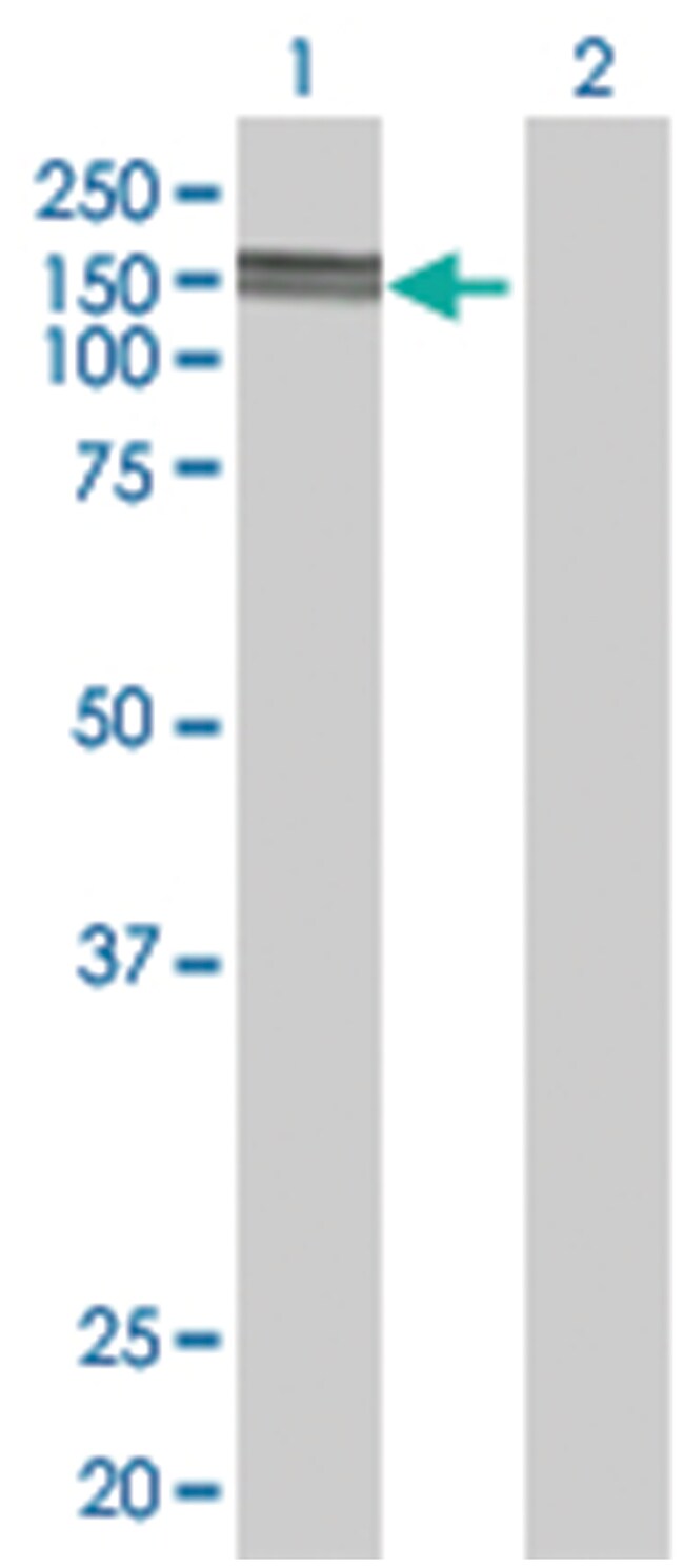 SORCS3 293T Cell Overexpression Lysate (Denatured), Abnova 100μL ...