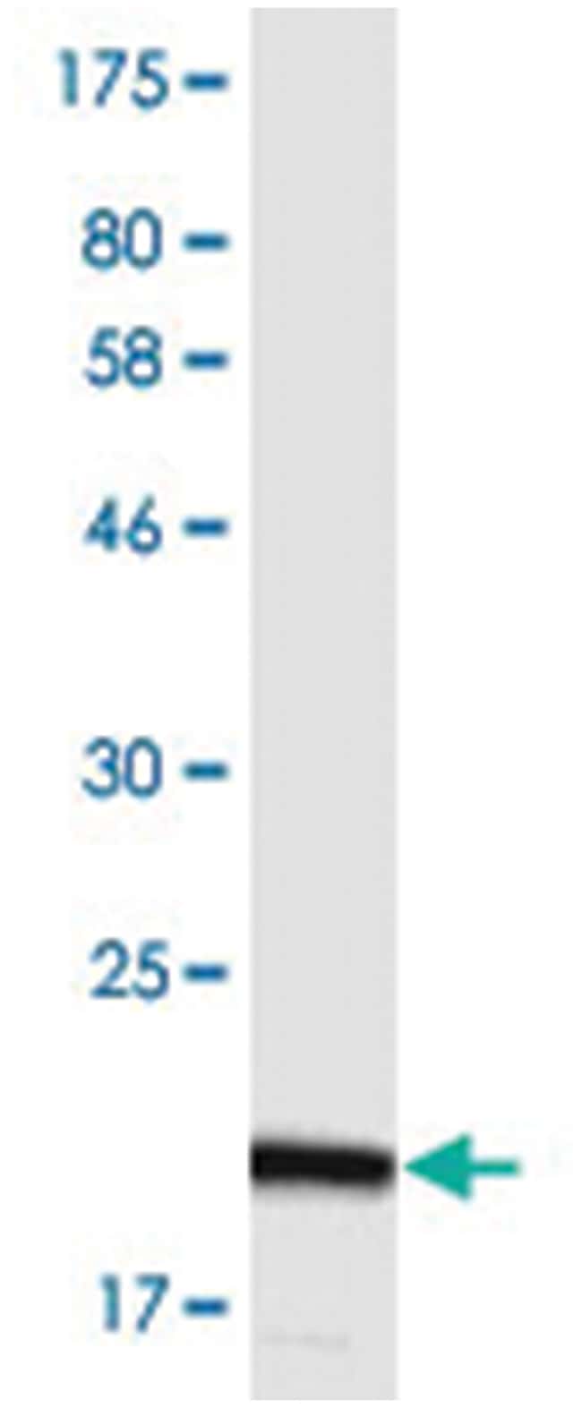 anti-TNFRSF13B, Clone: 1H5, Abnova 100μg, Unlabeled:Antibodies ...