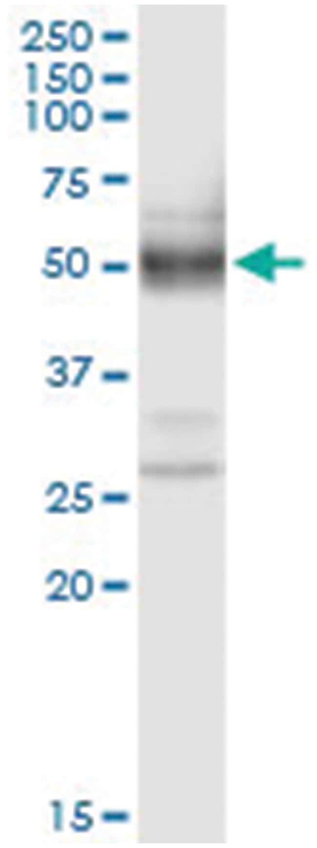 anti-PLA2G15, Human, IP-WB Antibody Pair, Abnova™ 1 Set anti-PLA2G15 ...