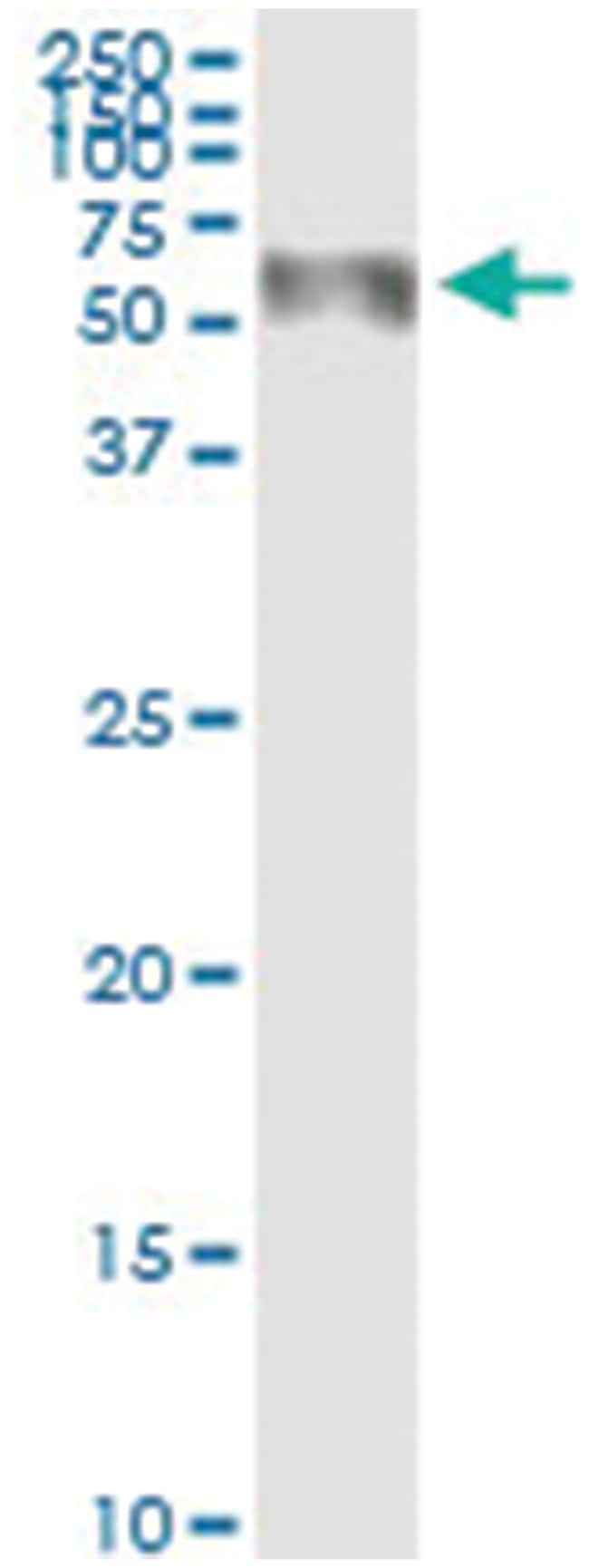 anti-PLA2G3, Human, IP-WB Antibody Pair, Abnova™ 1 Set Matched Primary ...