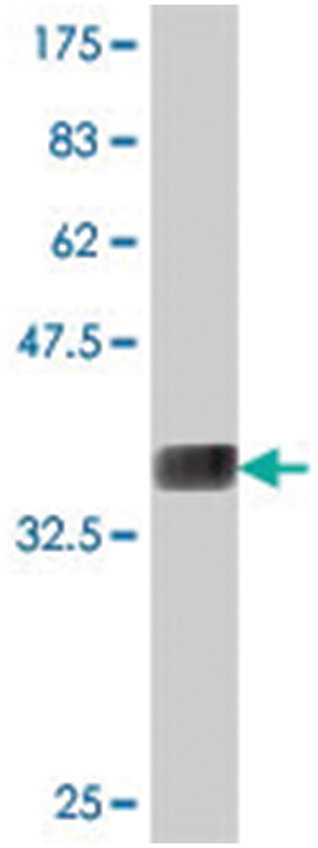 NAGPA, Mouse, Polyclonal Antibody, Abnova™ 50μL; Unlabeled | Fisher ...