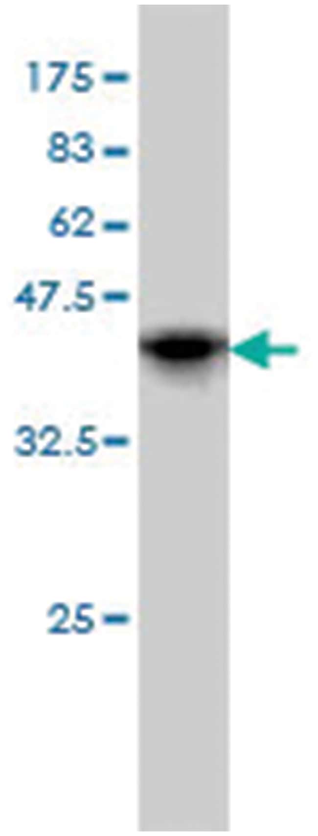 TAO kinase 3, Mouse, Clone: 4A2, Abnova 100μg; Unlabeled:Antibodies ...