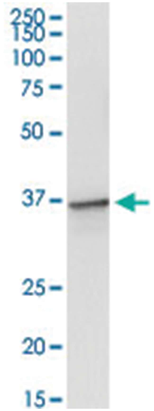 TOLLIP, Human, IP-WB Antibody Pair (PW3), Abnova 1 Set:Antibodies ...