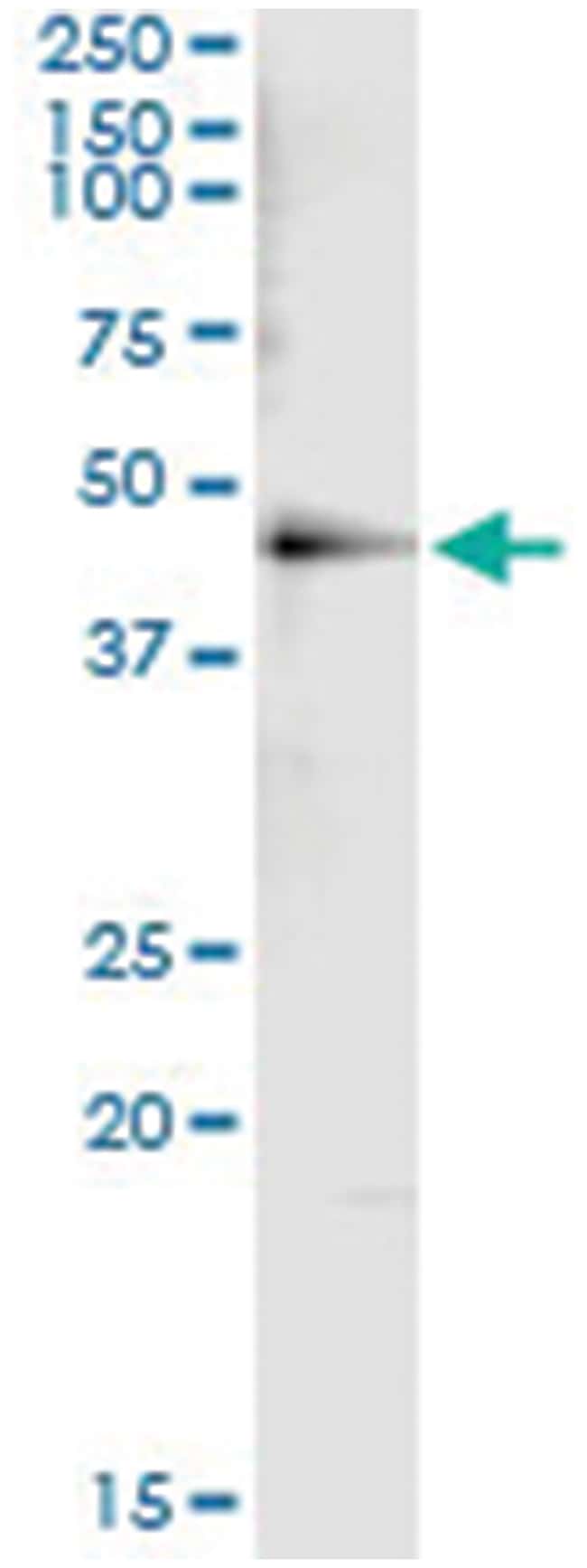HDAC8, Human, IP-WB Antibody Pair (PW2), Abnova™ 1 Set Matched Primary ...