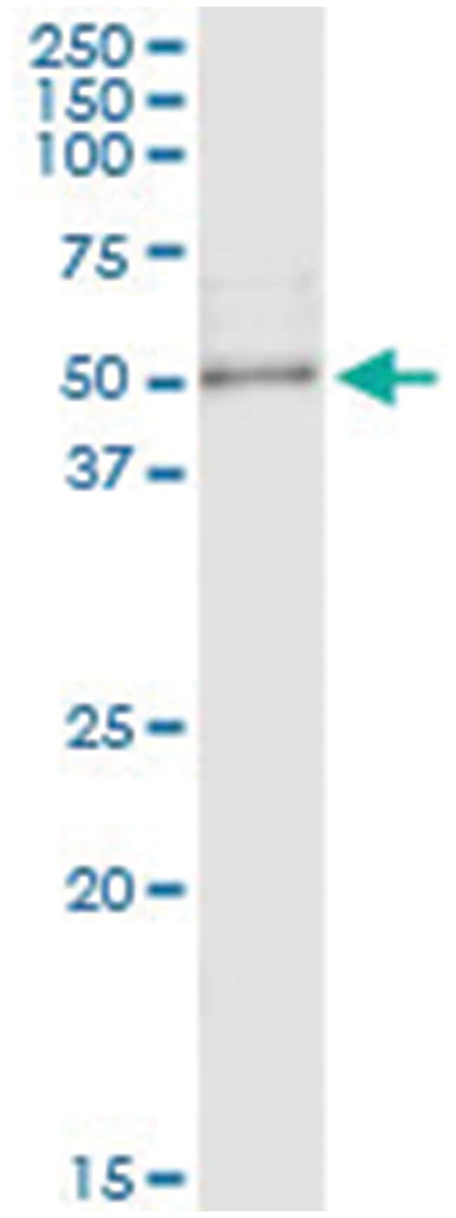 RPTOR, Human, IP-WB Antibody Pair (PW1), Abnova 1 Set:Antibodies ...