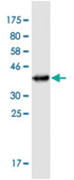 CHD8, Mouse, Clone: 2C8, Abnova 200μL; Unlabeled:Anticorps, Monoclonal ...
