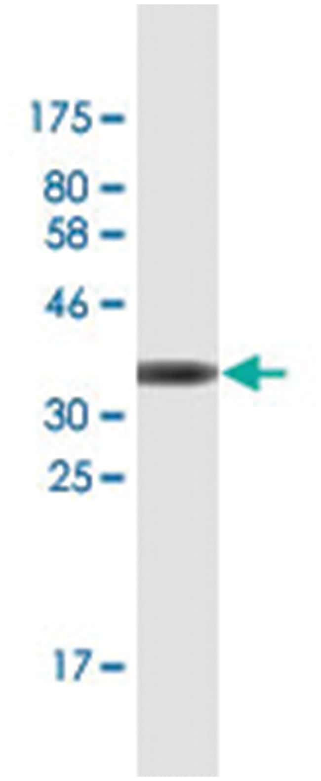 FBXO11, Mouse, Clone: 4C12, Abnova™ 200μL; Unlabeled FBXO11, Mouse, Clone: 4C12, Abnova ...
