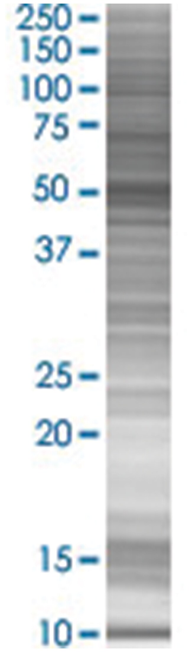 SCIN 293T Cell Overexpression Lysate (Denatured), Abnova 100μL:Protein ...