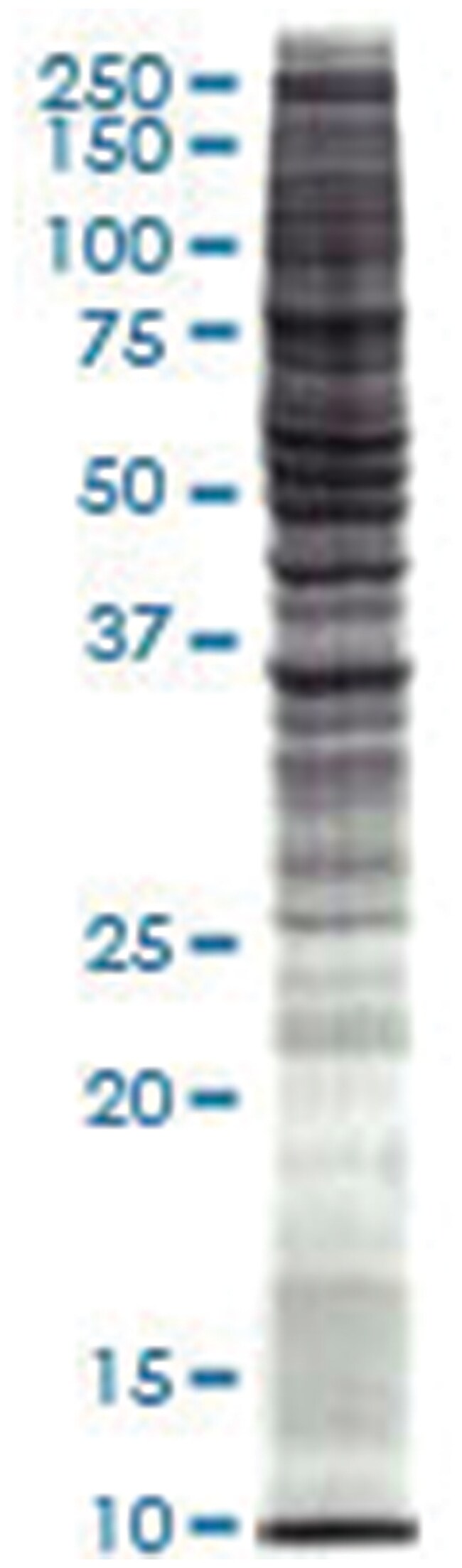 C32 (human amelanotic melanoma) Whole cell lysate, Denatured; Abnova ...