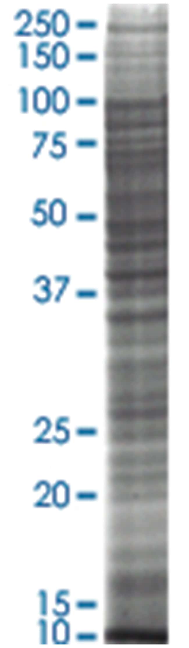 HCT 116 (human colorectal carcinoma) Whole cell lysate, Non-denatured ...