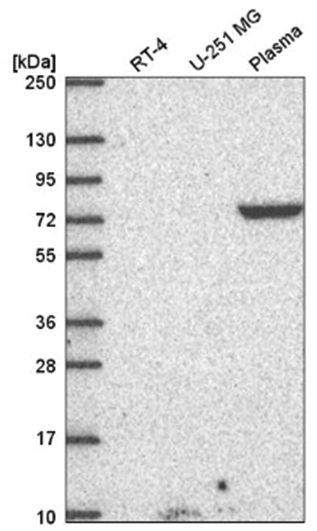 Dopamine beta-Hydroxylase Antibody, Novus Biologicals 100μL; Unlabeled ...