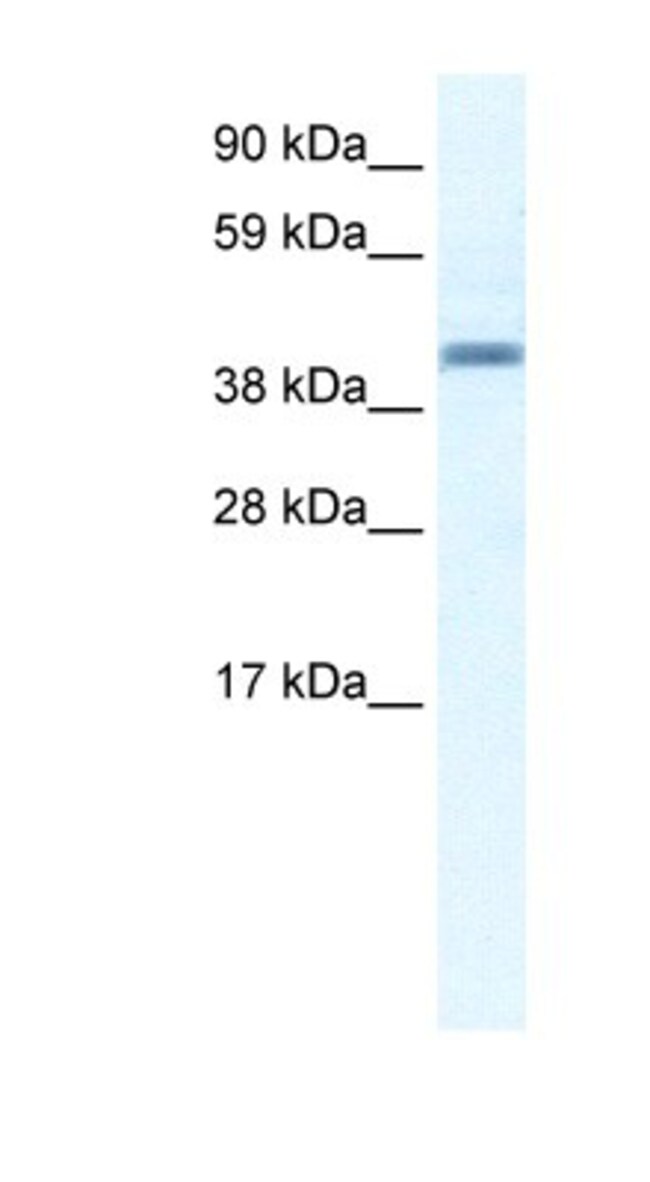 PRIM ANTBDY NBP1-59099-20UL