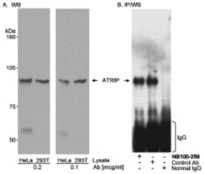 ATRIP - 0.1 ML