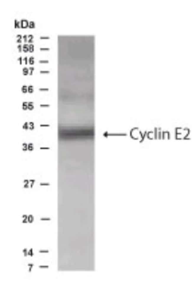 CYCLIN E2 - 0.025 MG