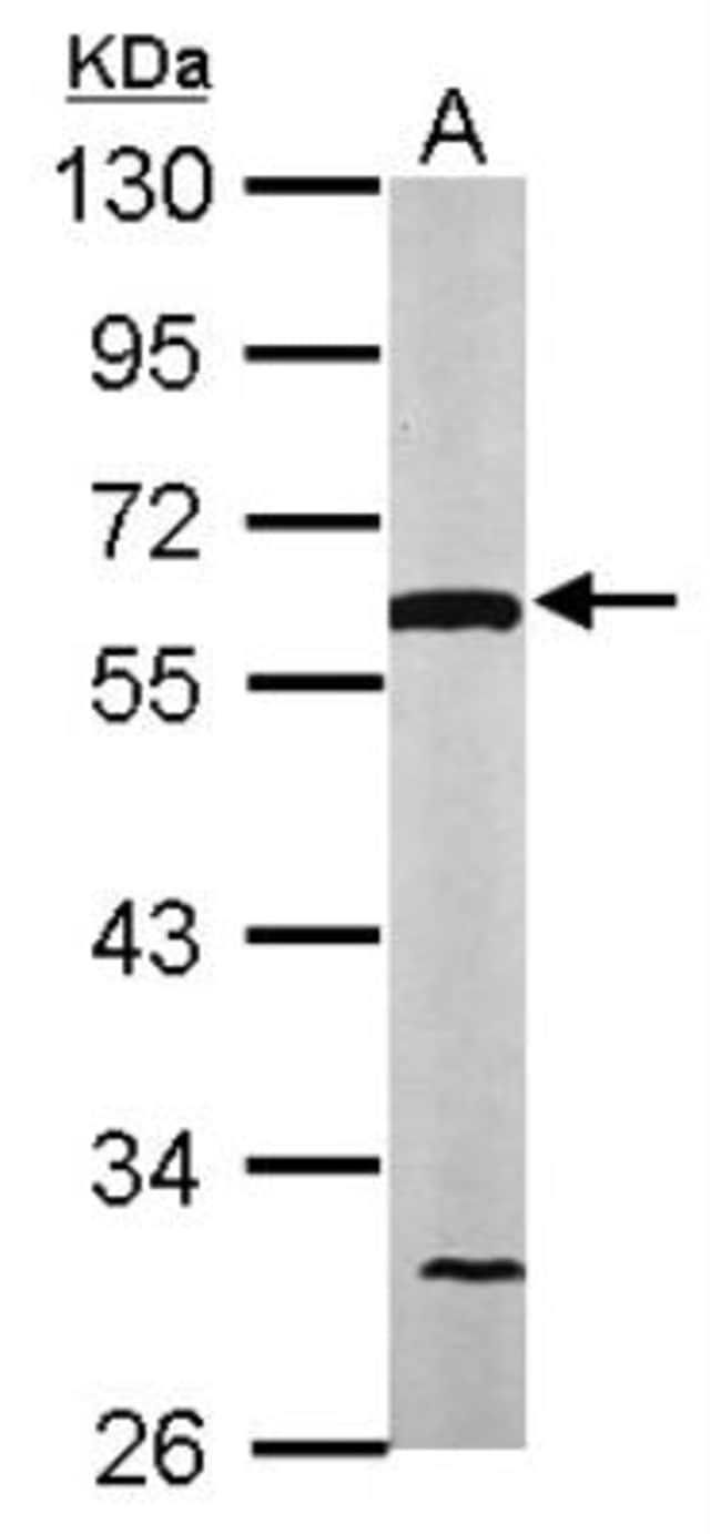LIPOAMIDE DEHYDROGENA - 0.1 ML