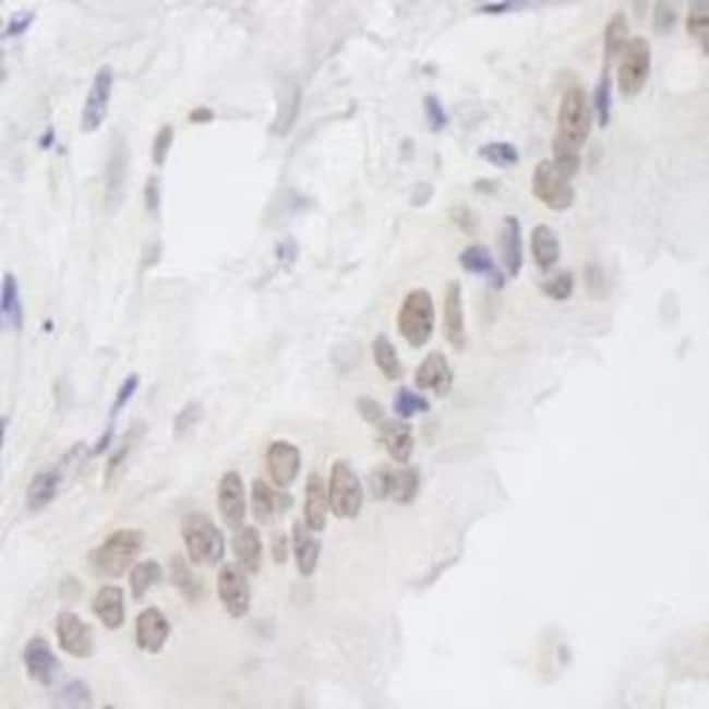 EMSY Antibody 0.1mg; Unlabeled:Antibodies, Polyclonal | Fisher Scientific