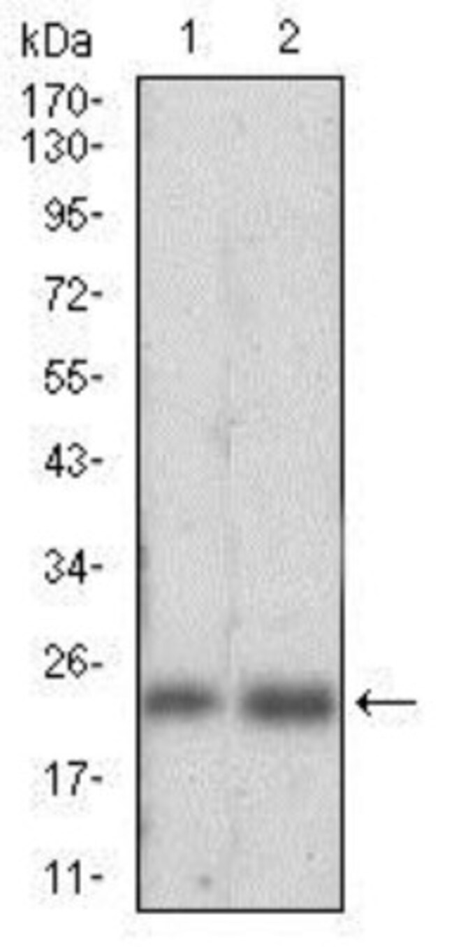 Ferritin Light Chain Antibody (6E10E4) - BSA Free, Novus Biologicals 0 ...