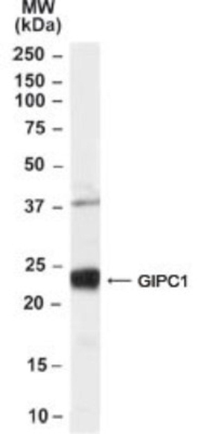 GIPC1 Antibody, Novus Biologicals 0.1mg; Unlabeled:Antibodies, Polyclonal | Fisher Scientific