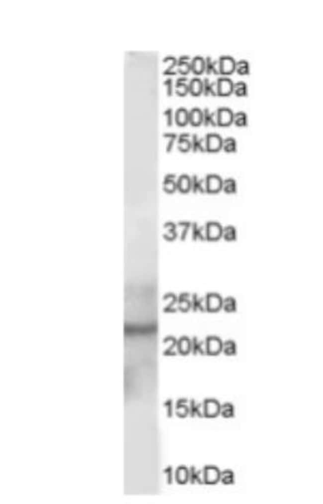 anti-Glutathione Peroxidase 2/GPX2, Polyclonal, Novus Biologicals 0.1mg ...