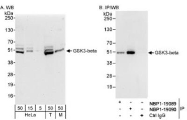 GSK-3 BETA - 0.1 ML