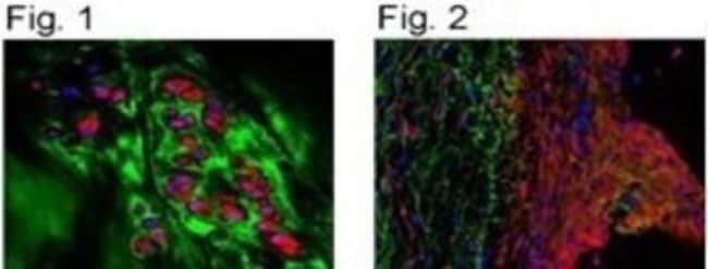 HC1 Antibody 100 μg; Unconjugated:Antibodies, Polyclonal | Fisher ...