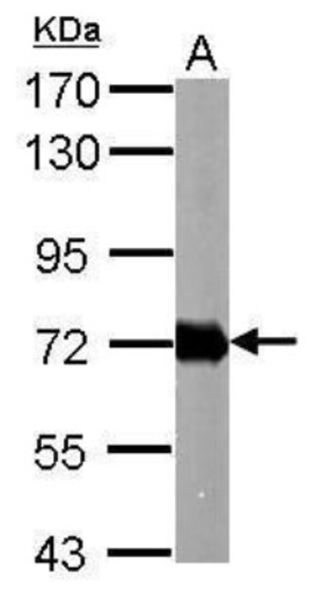 Helicobacter pylori urease B Antibody, Novus Biologicals™ 0.1mL ...