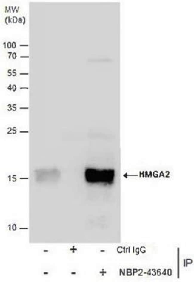 HMGA2 (763) - 0.1 ML