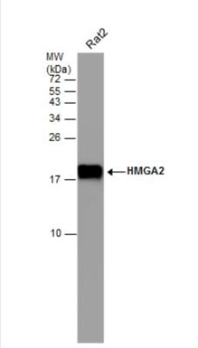HMGA2 (763) - 0.1 ML