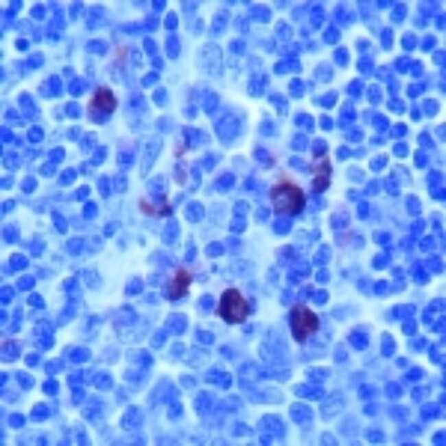 anti-IgM, Clone: R1/69, Novus Biologicals 1mL; Unlabeled:Life Sciences ...