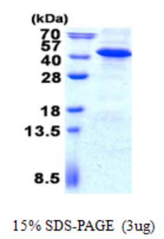 Novus Biologicals™ Recombinant Human Inositol Monophosphatase 3/IMPAD1 ... Novus Biologicals™ Recombinant Human Inositol Monophosphatase 3/IMPAD1 ...