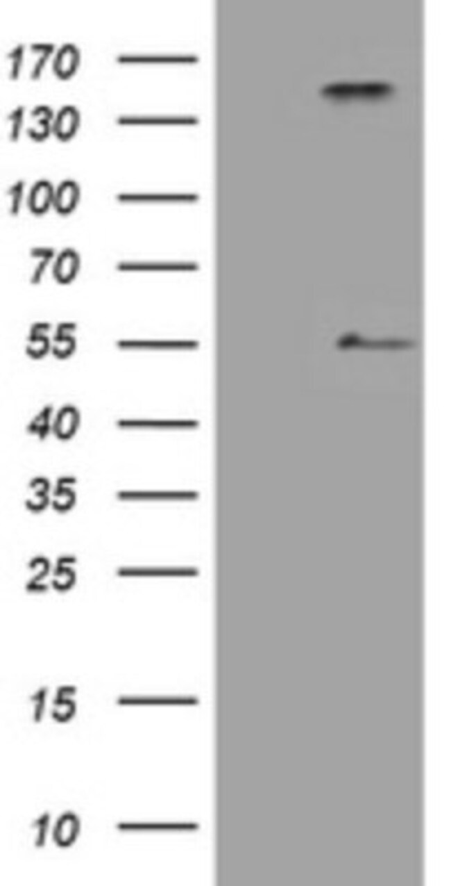 INHIBIN ALPHA (12F11 - 0.1 ML