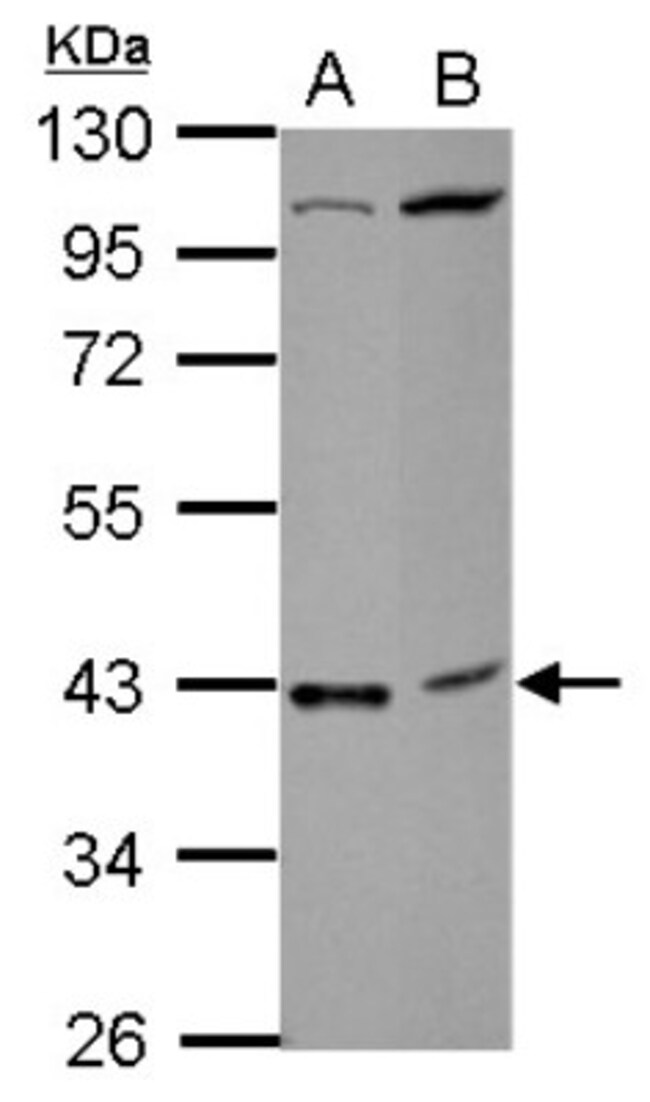 LAS2 Antibody, Novus Biologicals 0.1mL; Unlabeled:Antibodies ...