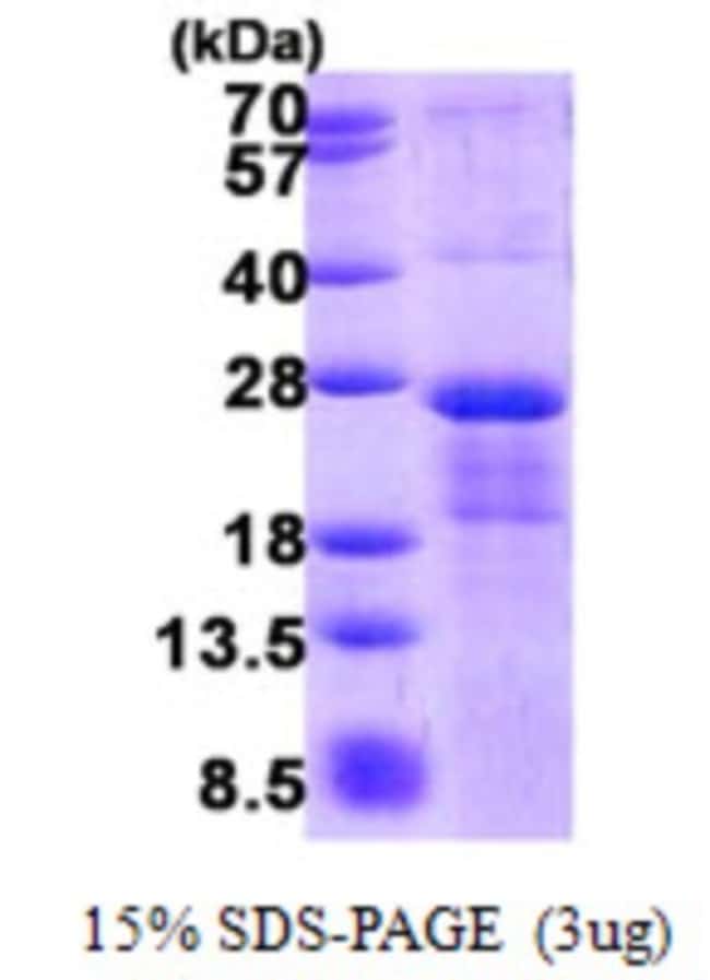 Novus Biologicals Recombinant Human CYREN His Protein 0.02mg ...