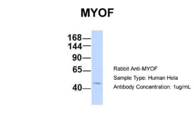 MYOFERLIN - 0.05 MG
