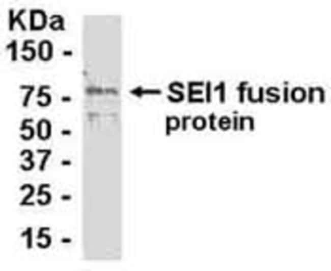 Sertad1 Antibody 0.05mg; Unlabeled:Antibodies, Polyclonal | Fisher ...