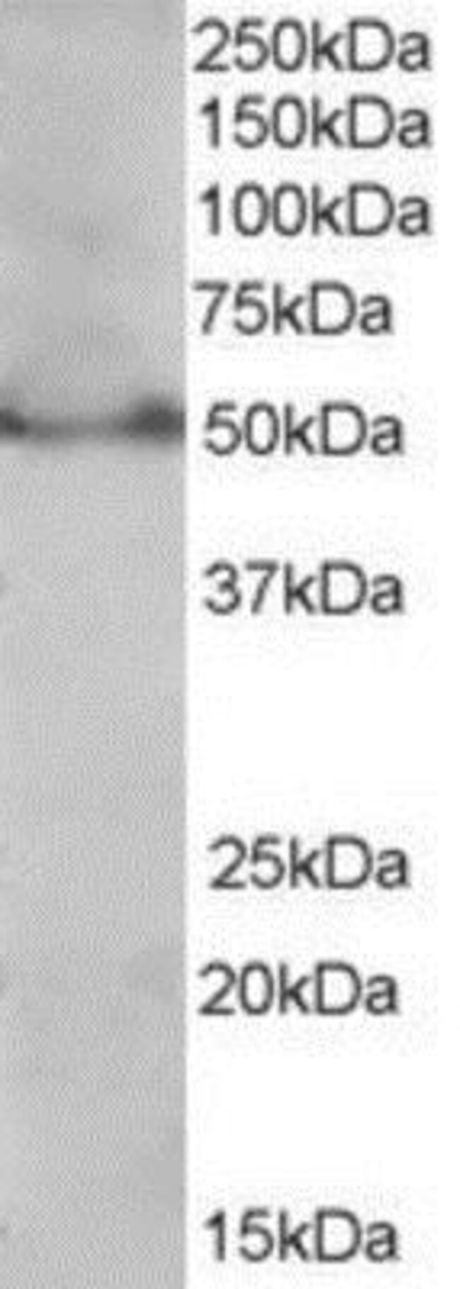 PPAR delta/NR1C2 Antibody 0.1mg; Unlabeled:Antibodies, Polyclonal ...