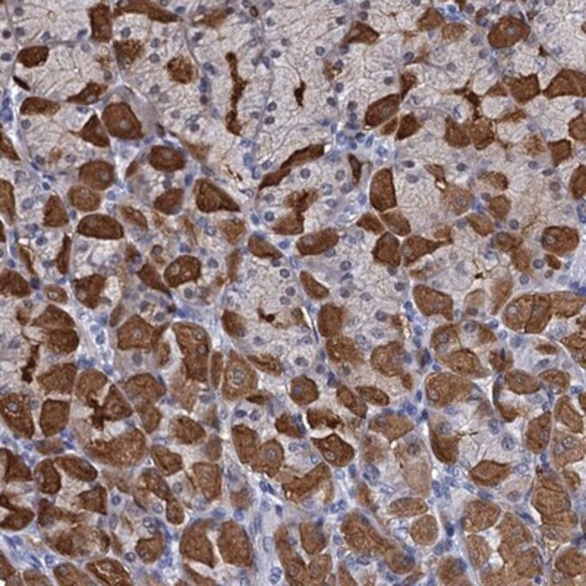 PSF3 Antibody, Novus Biologicals 0.1mL; Unlabeled:Antibodies ...