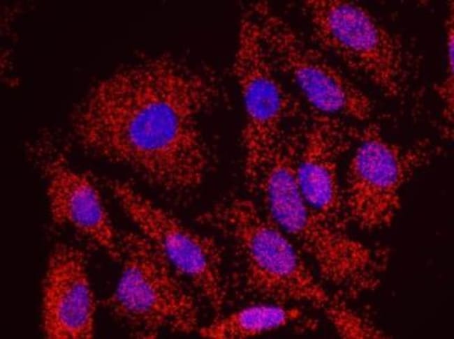 PSRC2 Antibody, Novus Biologicals 0.1mL; Unlabeled:Antibodies, Polyclonal | Fisher Scientific
