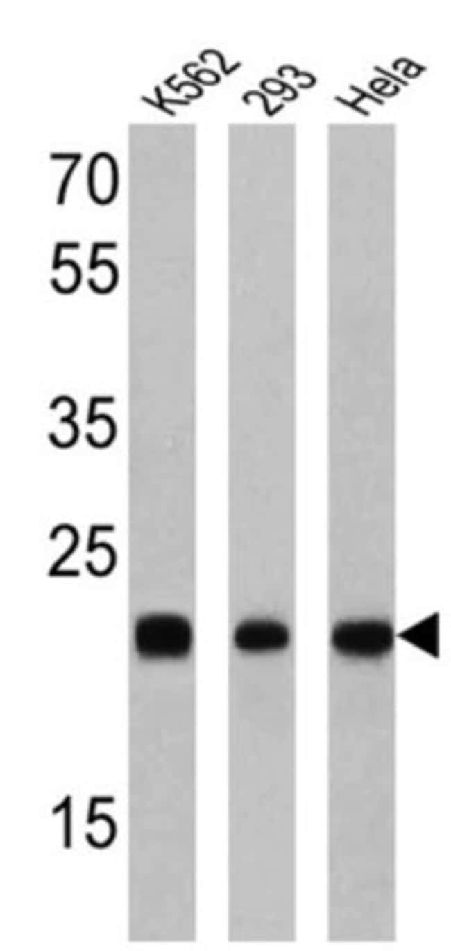 RAB9A (MAB9) - 0.1 ML