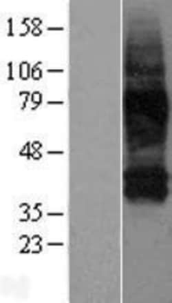 Novus Biologicals SLC38A3 Overexpression Lysate 0.1mg:Protein Analysis ...