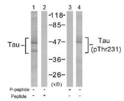 Tau Antibody, Novus Biologicals 0.025 mL; Unconjugated:Antibodies, Polyclonal | Fisher Scientific