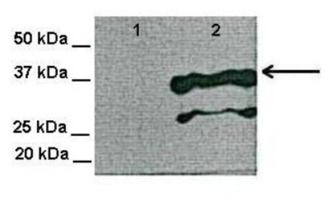 TSPAN3 Rabbit anti-Human, Polyclonal, Novus Biologicals 20μL; Unlabeled ...
