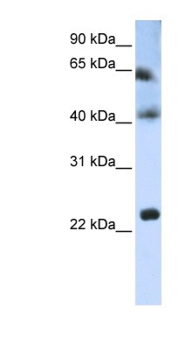 TSPAN3 Rabbit anti-Human, Polyclonal, Novus Biologicals 20μL; Unlabeled ...