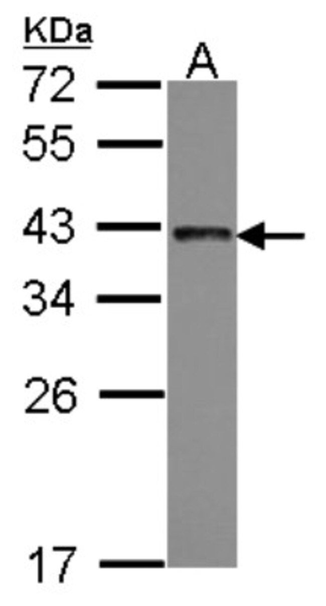 TRA2B Antibody, Novus Biologicals 0.1mL; Unlabeled:Antibodies ...