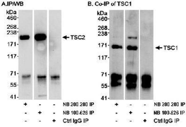 TSC2 Antibody 0.1mg; Unlabeled:Antibodies, Polyclonal | Fisher Scientific