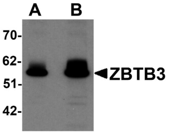 ZBTB3 Antibody - BSA Free, Novus Biologicals 0.1mg; Unlabeled ...