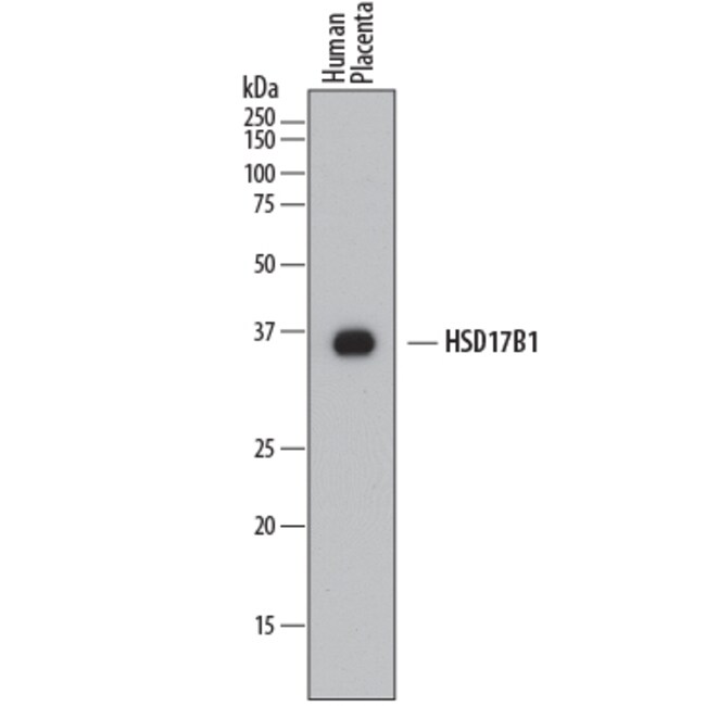 Human 17 beta-HSD1/HSD17B1 Antibody 25μg; Unlabeled:Antibodies ...